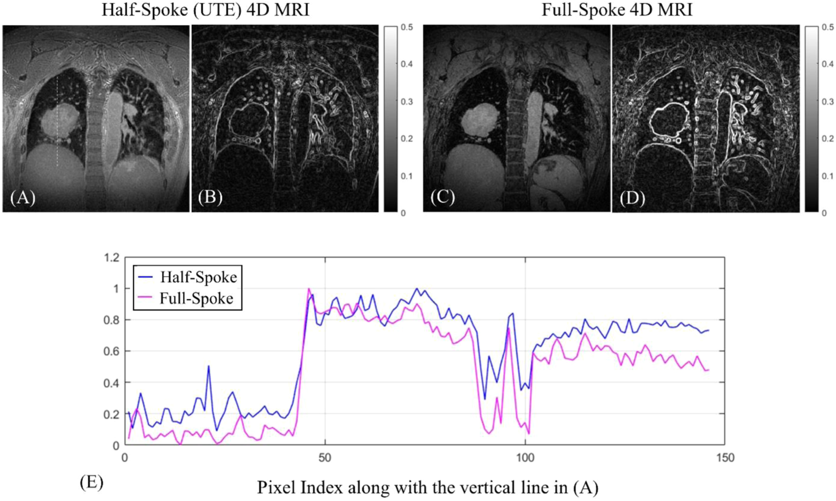 4D lung MRI with high-isotropic-resolution using half-spoke (UTE) and ...