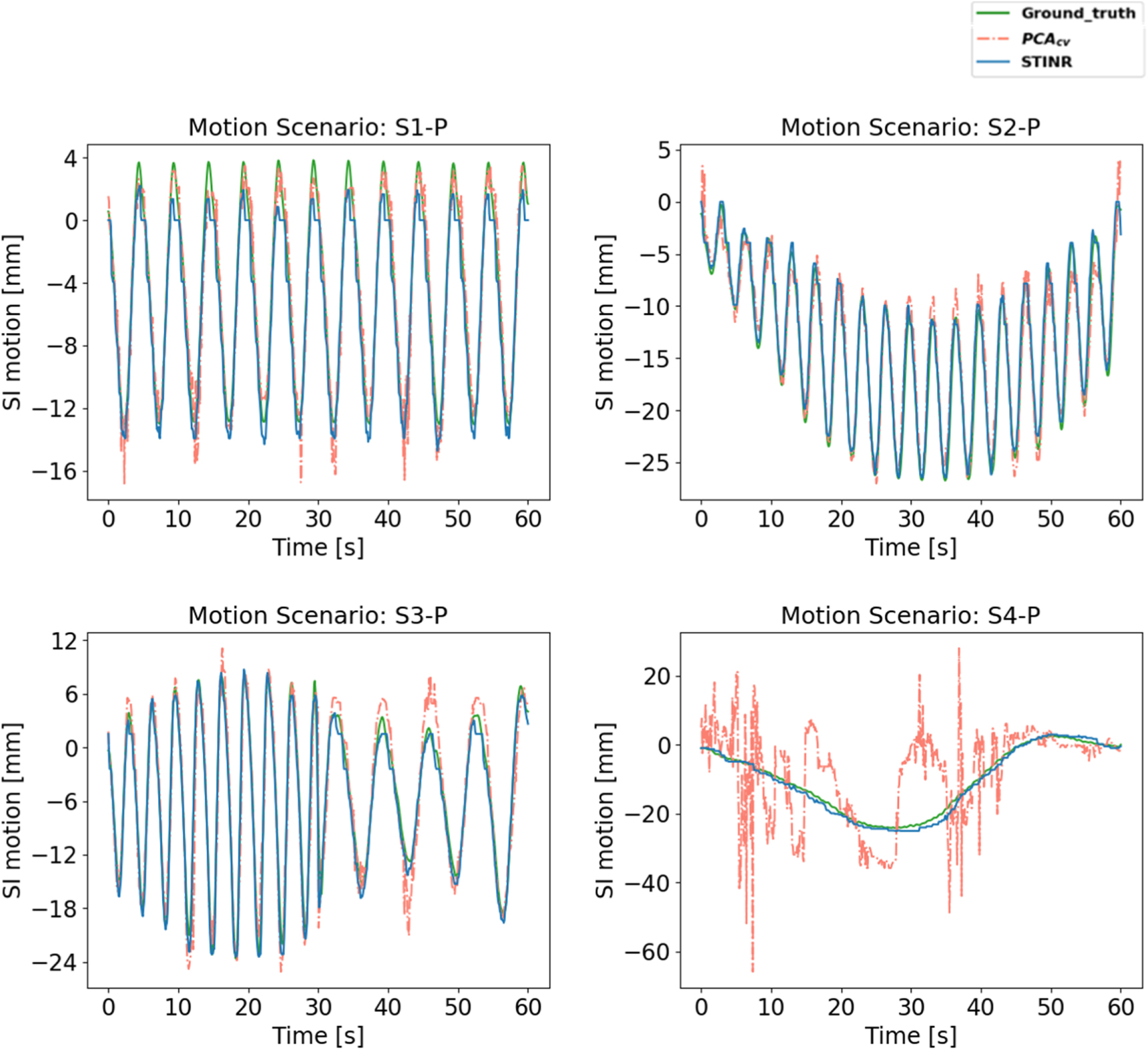 Dynamic cone-beam CT reconstruction using spatial and temporal implicit neural representation ...
