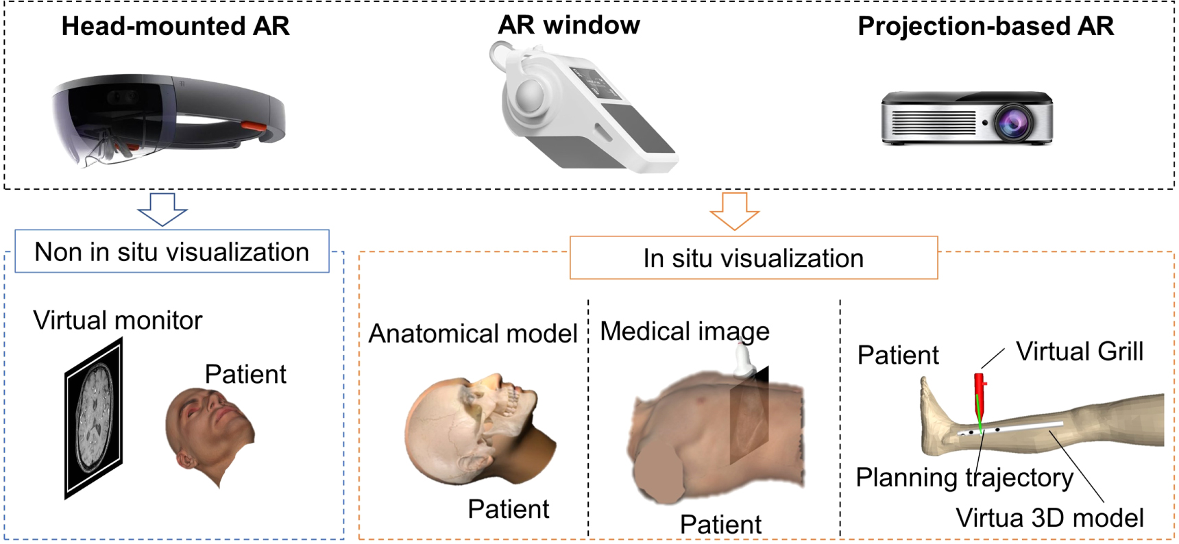 Visualization, registration and tracking techniques for augmented ...