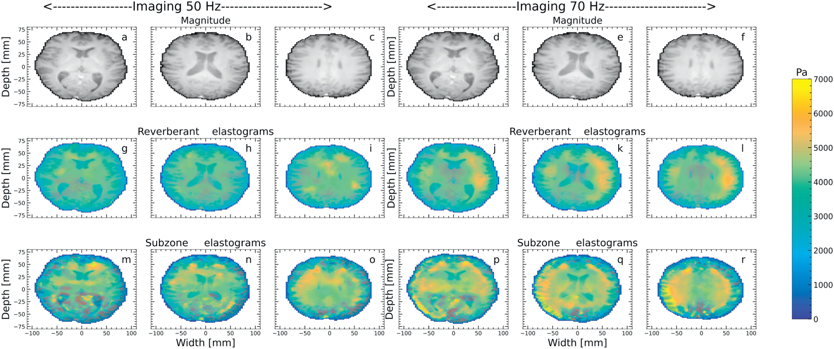 Reverberant magnetic resonance elastographic imaging using a single ...