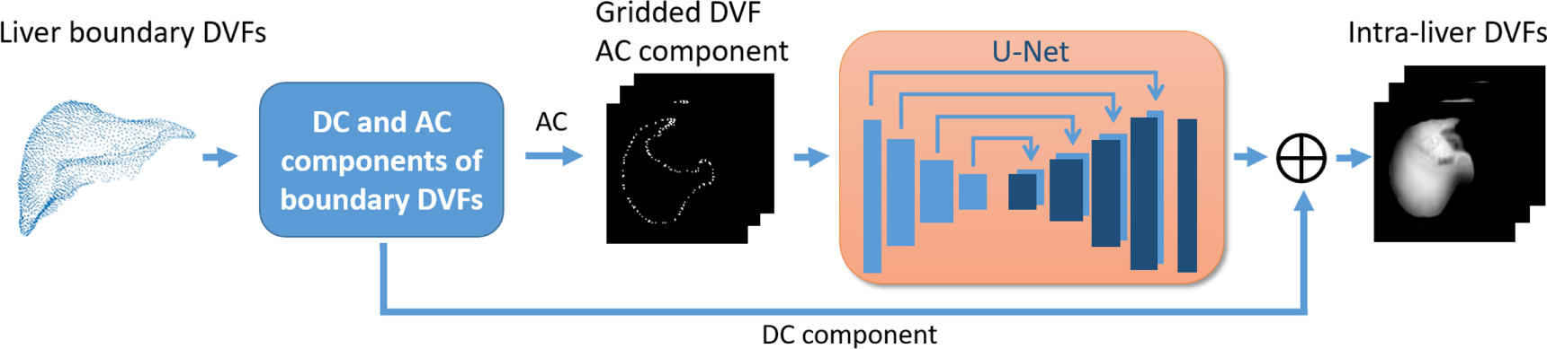 Real-time liver tumor localization via combined surface imaging and a ...