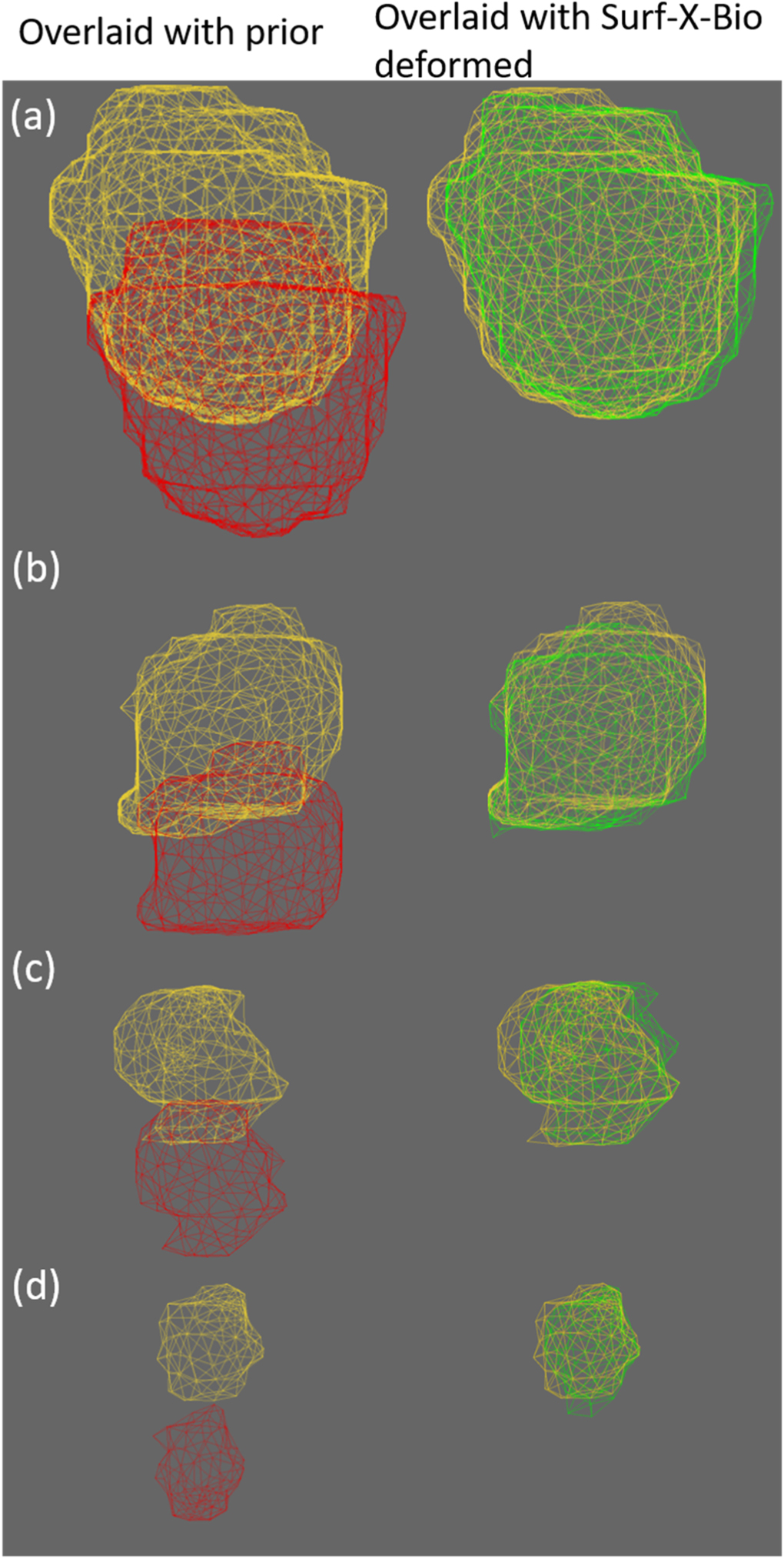 Real-time liver tumor localization via combined surface imaging and a ...