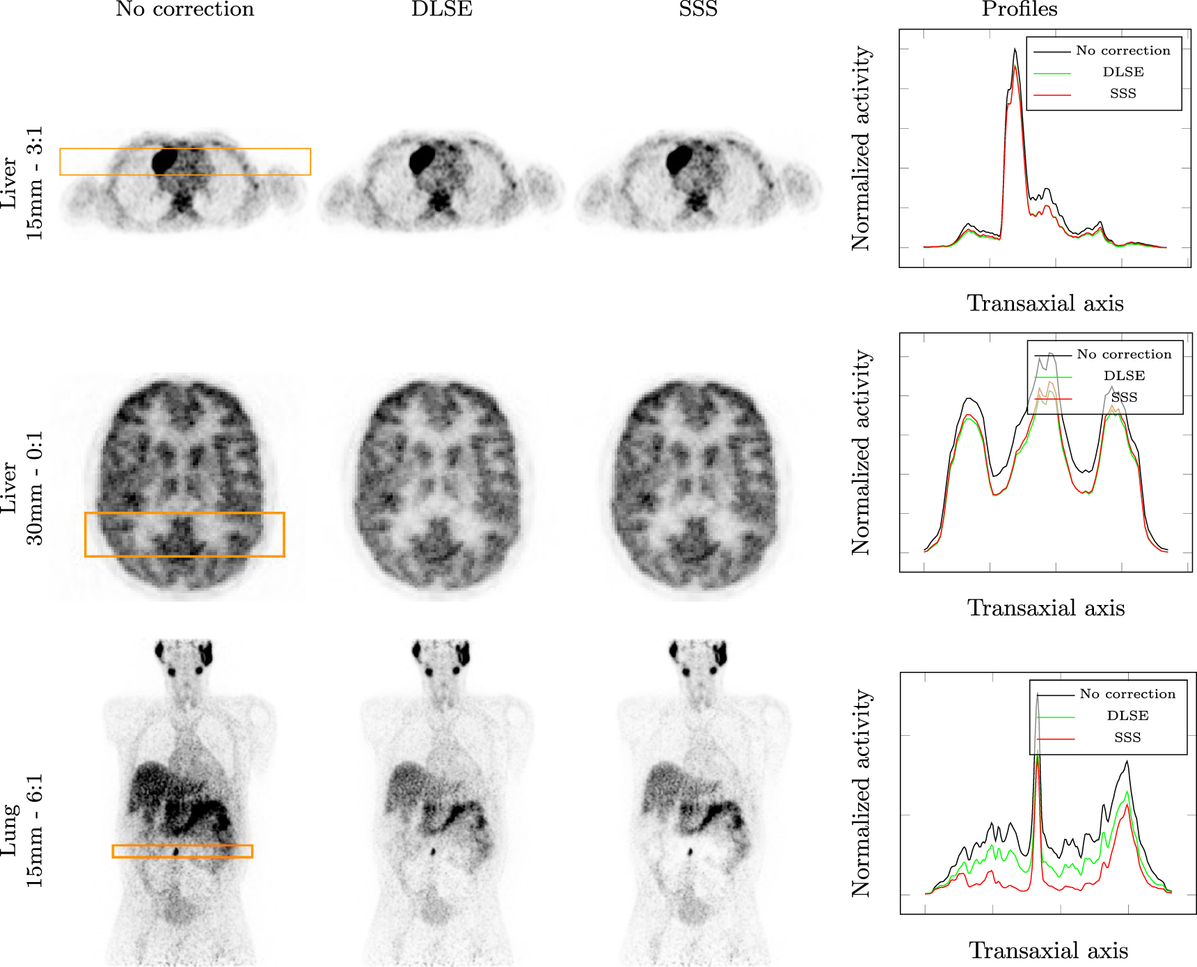 PET scatter estimation using deep learning U-Net architecture - IOPscience