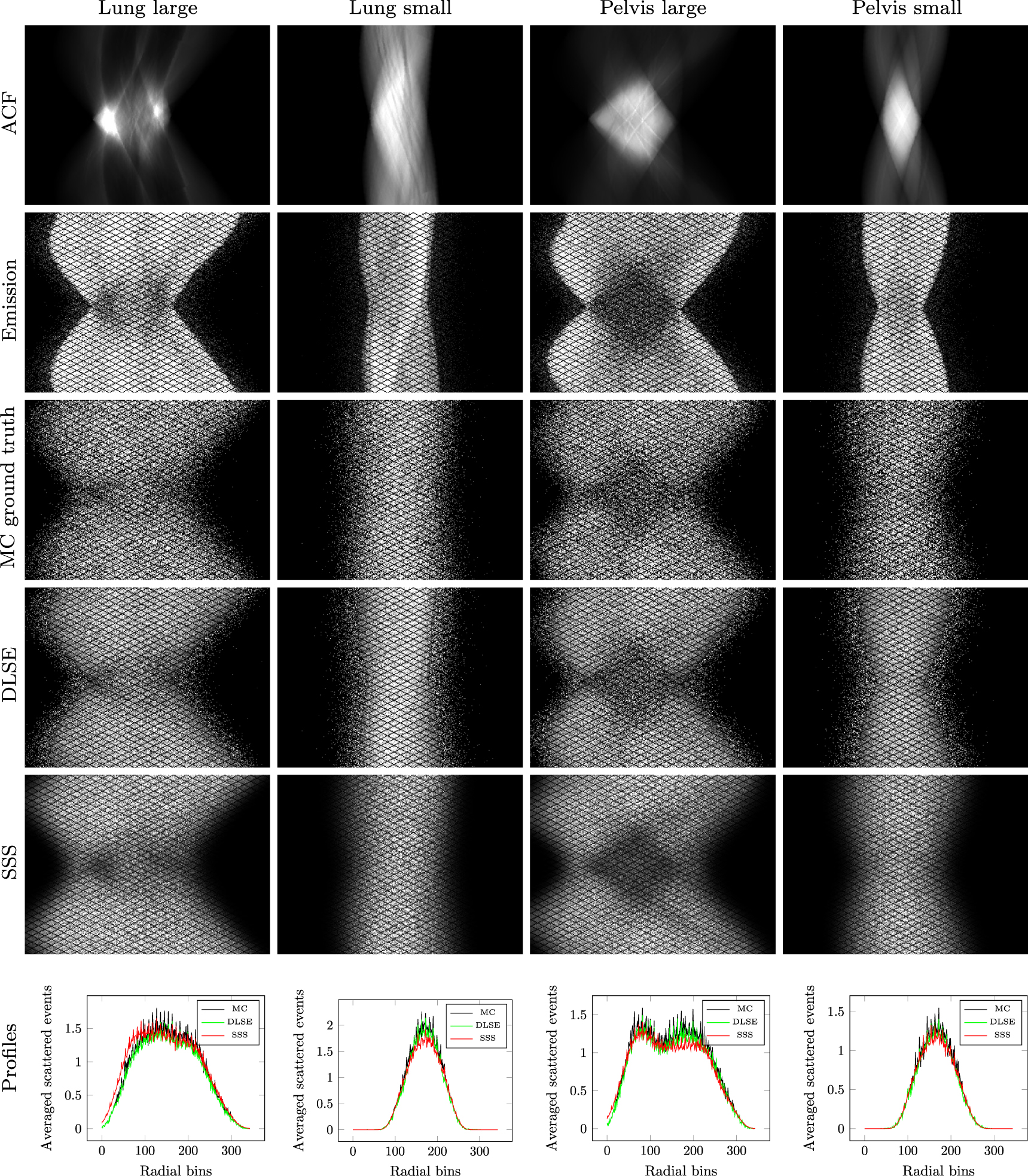 PET scatter estimation using deep learning U-Net architecture - IOPscience