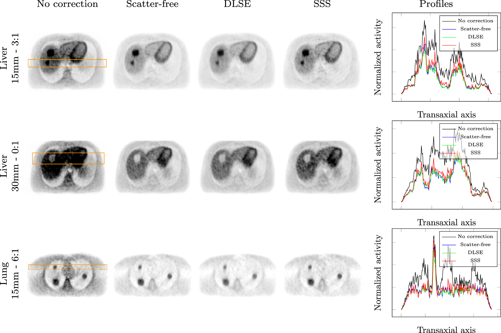 PET scatter estimation using deep learning U-Net architecture - IOPscience