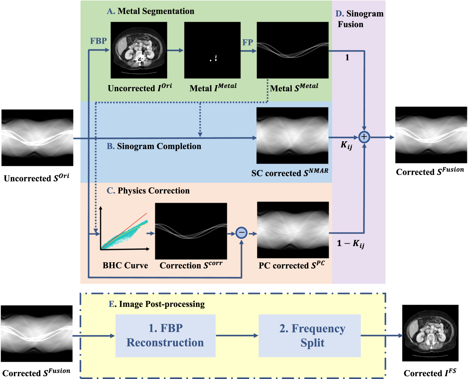 Physics-informed sinogram completion for metal artifact reduction in CT ...
