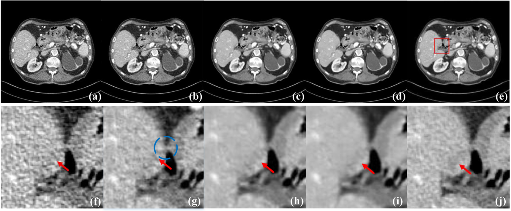 CTformer: convolution-free Token2Token dilated vision transformer for ...