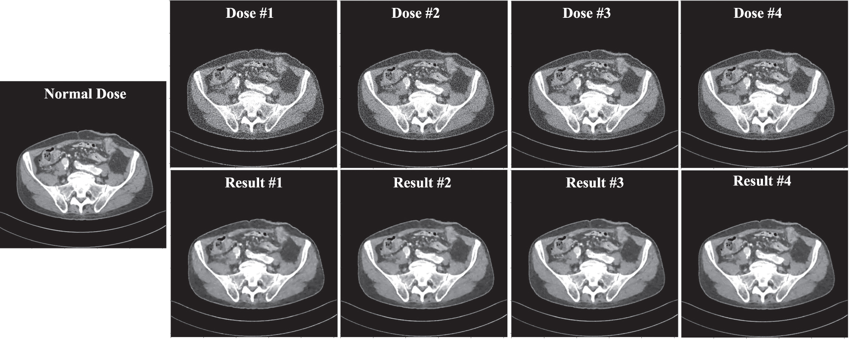 CTformer: convolution-free Token2Token dilated vision transformer for ...
