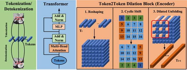 CTformer: convolution-free Token2Token dilated vision transformer for ...