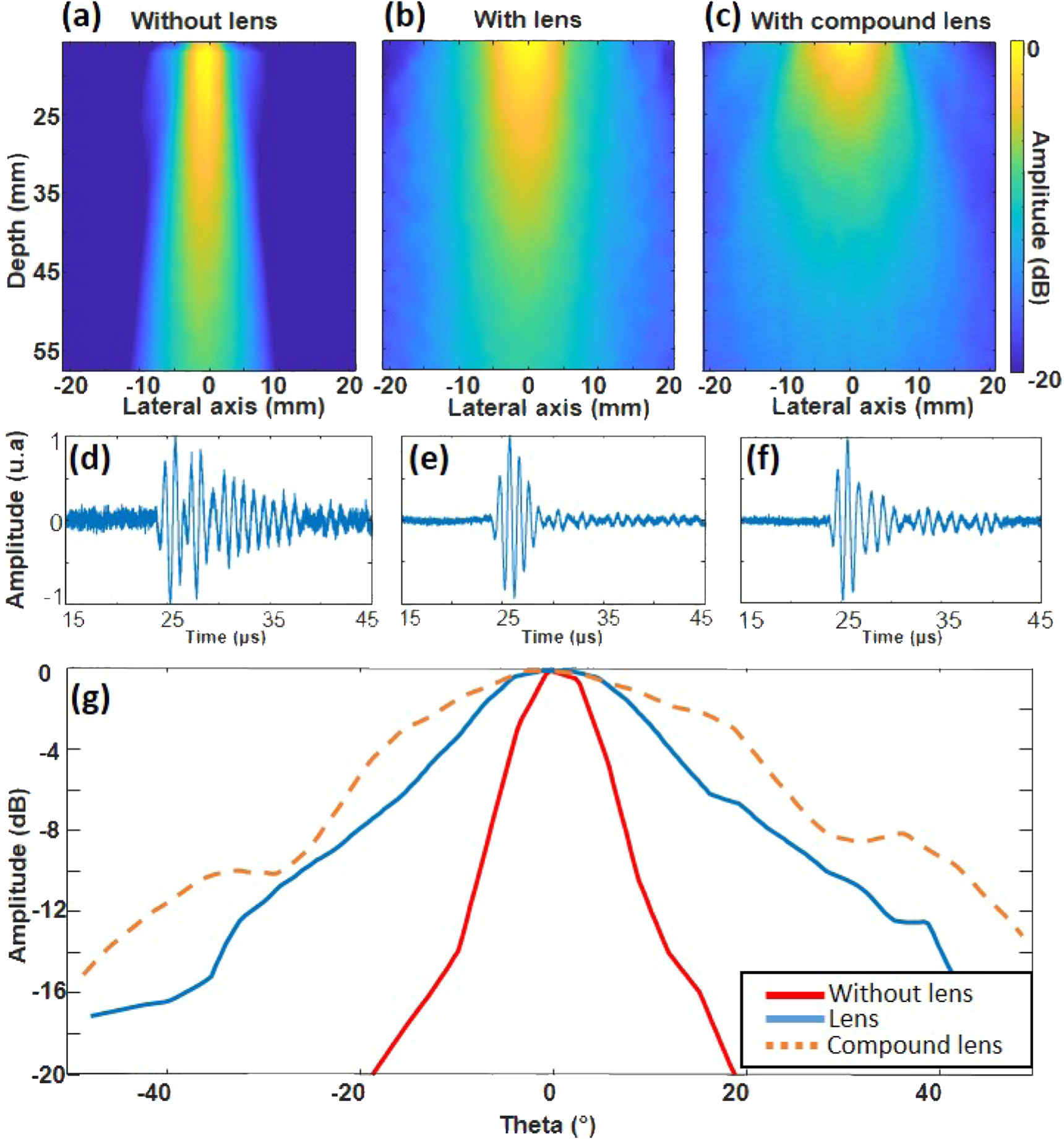 Transcranial 3D ultrasound localization microscopy using a large ...