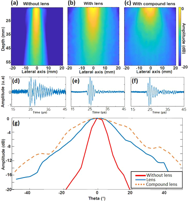 Transcranial 3D ultrasound localization microscopy using a large ...