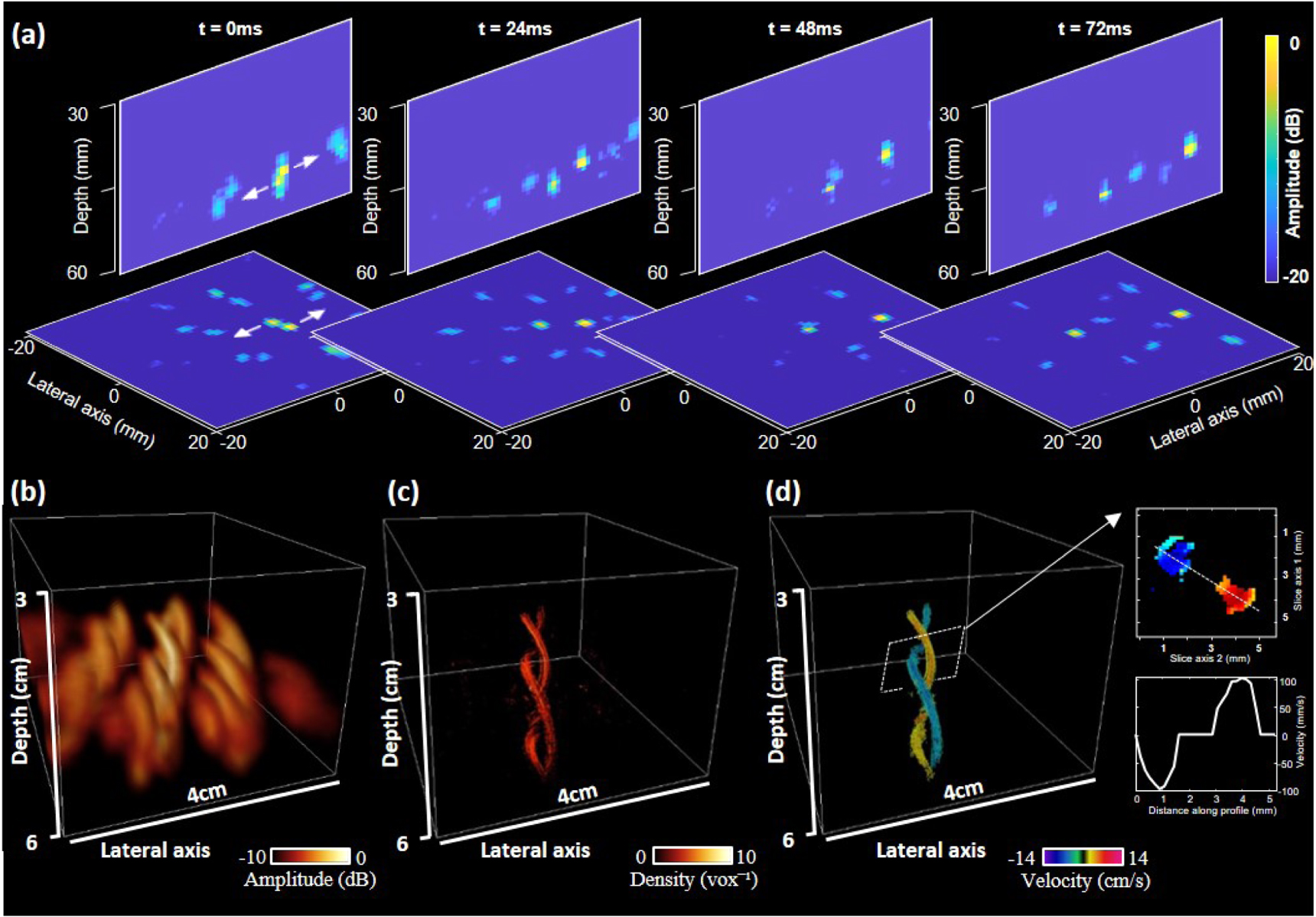 Transcranial 3D ultrasound localization microscopy using a large ...