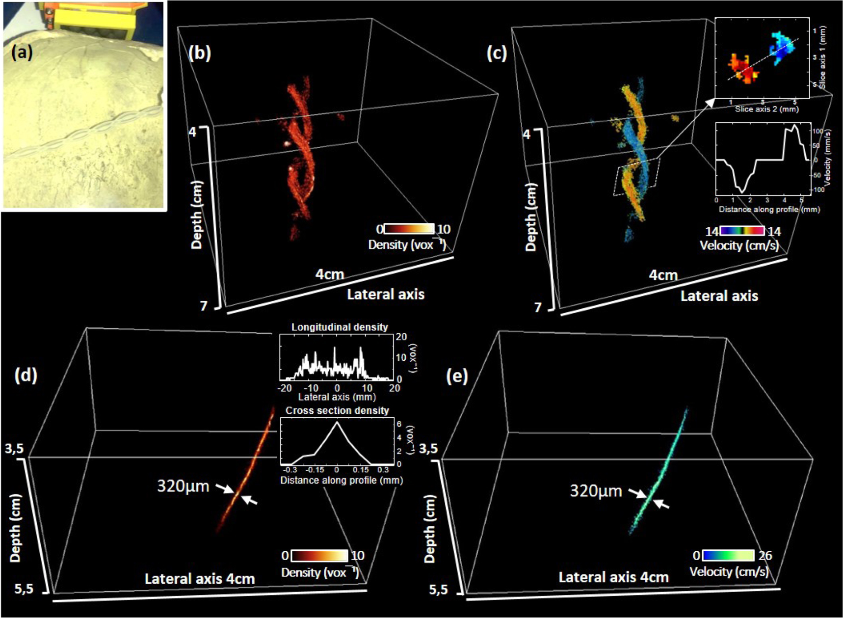 Transcranial 3D ultrasound localization microscopy using a large ...
