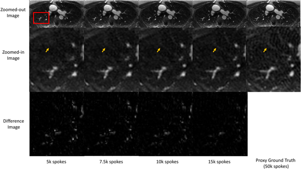 Memory efficient model based deep learning reconstructions for high spatial resolution 3D non ...