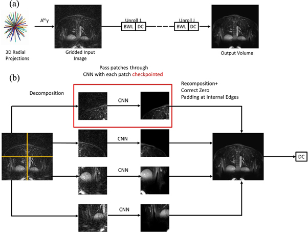 Memory efficient model based deep learning reconstructions for high spatial resolution 3D non ...