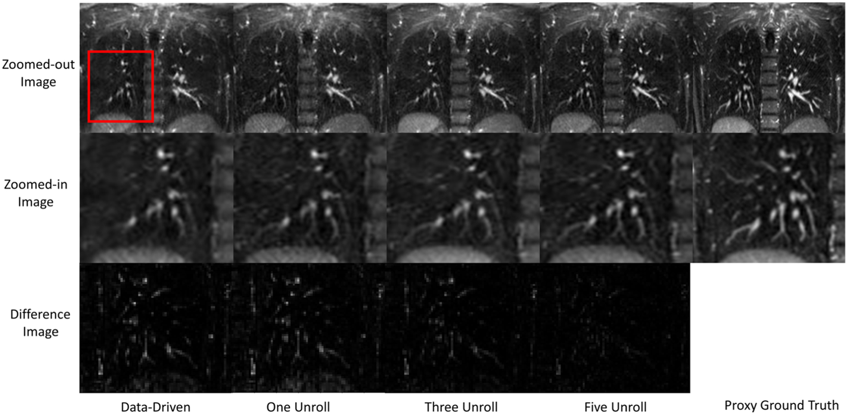 Memory efficient model based deep learning reconstructions for high spatial resolution 3D non ...