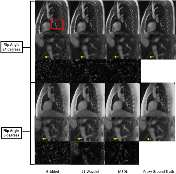Memory efficient model based deep learning reconstructions for high spatial resolution 3D non ...