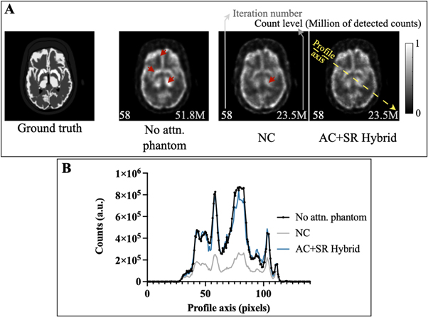 Mesh modeling of system geometry and anatomy phantoms for realistic ...