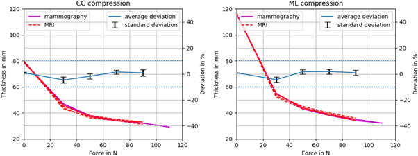 Towards a biomechanical breast model to simulate and investigate breast ...