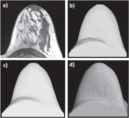 Towards a biomechanical breast model to simulate and investigate breast ...