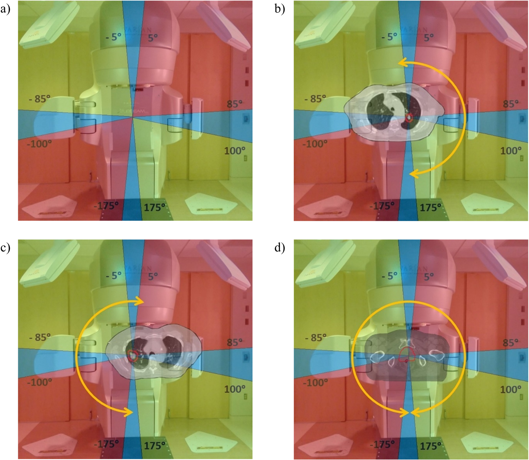 Estimation of patient-size dependent imaging dose for stereoscopic ...
