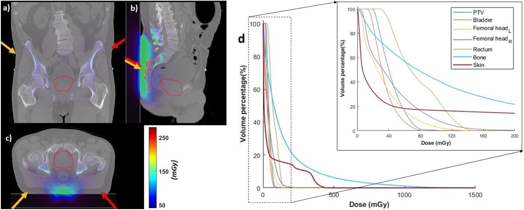 Estimation of patient-size dependent imaging dose for stereoscopic ...