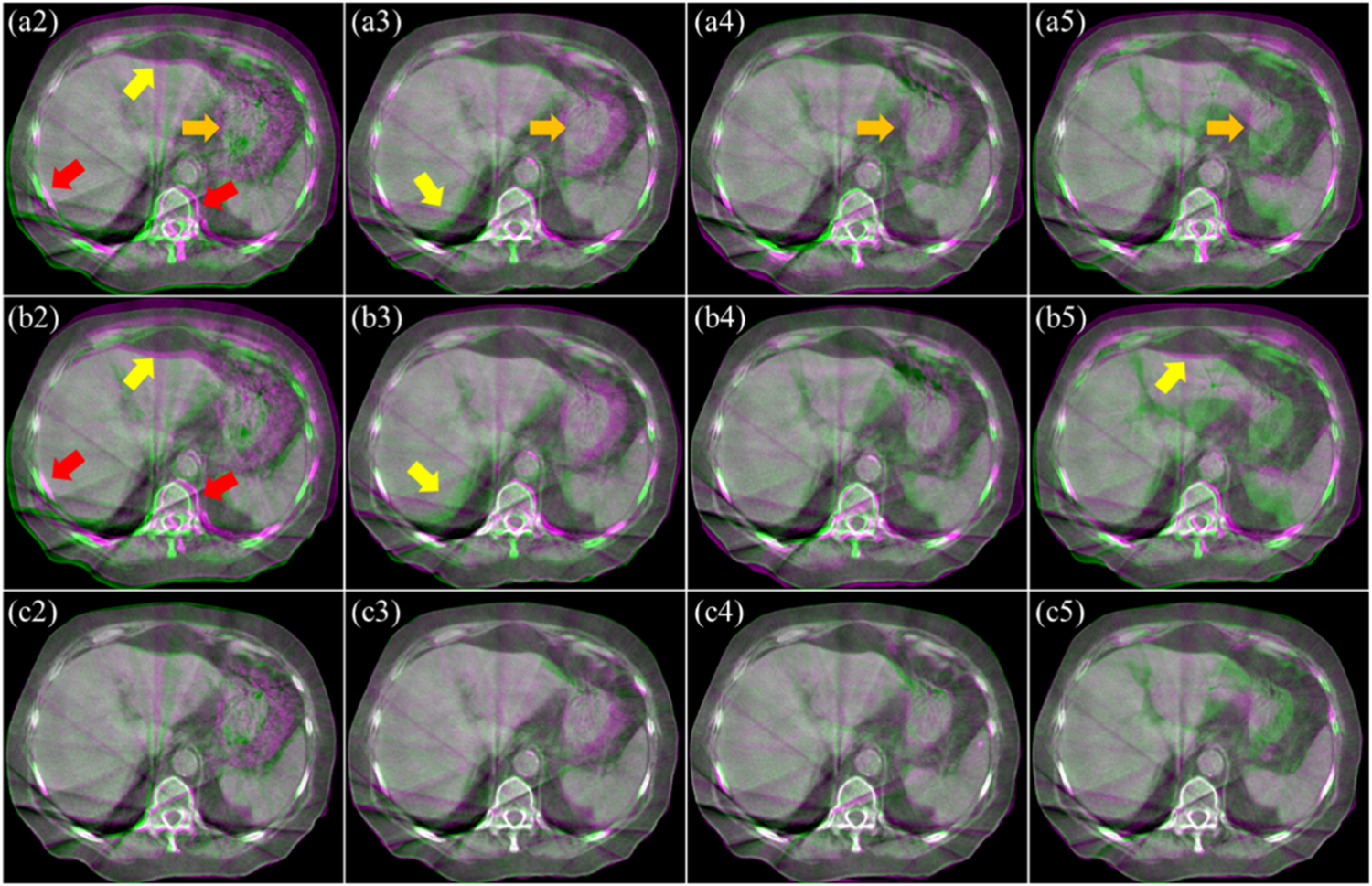 Inter-fraction deformable image registration using unsupervised deep ...