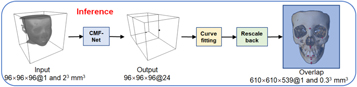 CMF-Net: craniomaxillofacial landmark localization on CBCT images using ...