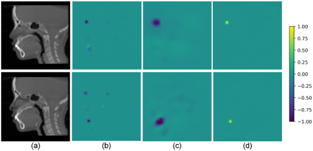 CMF-Net: craniomaxillofacial landmark localization on CBCT images using ...