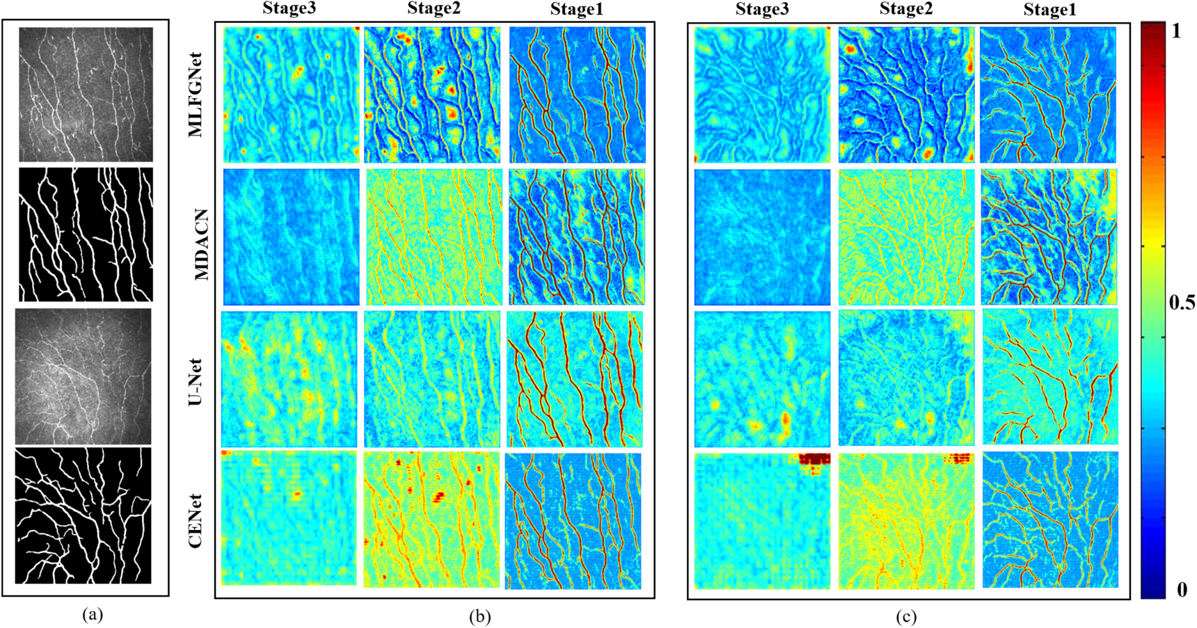 Multi-scale and local feature guidance network for corneal nerve fiber ...