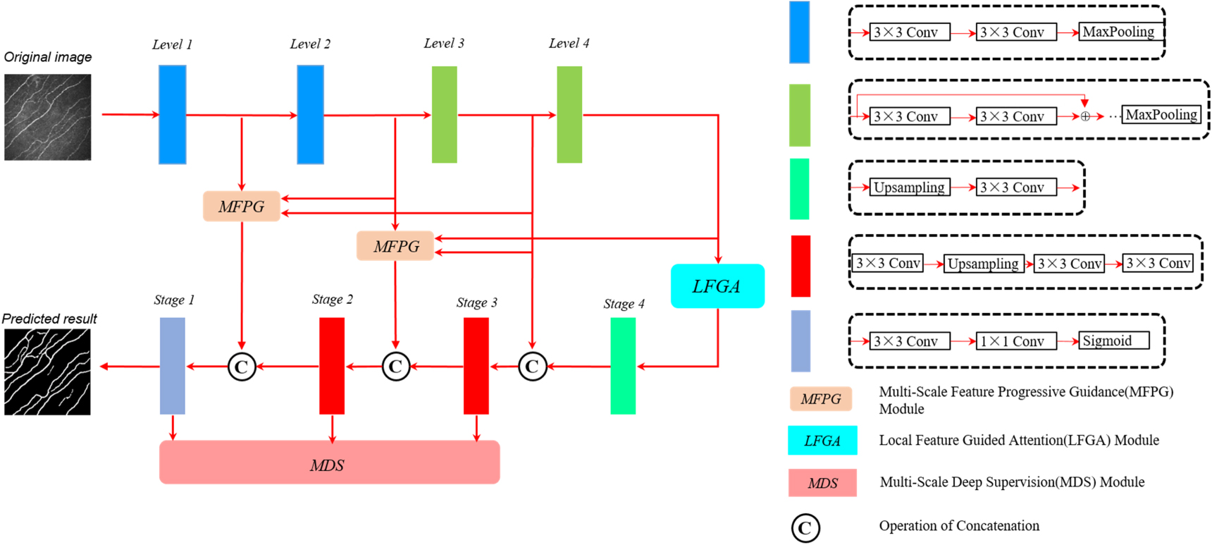 Multi-scale and local feature guidance network for corneal nerve fiber ...