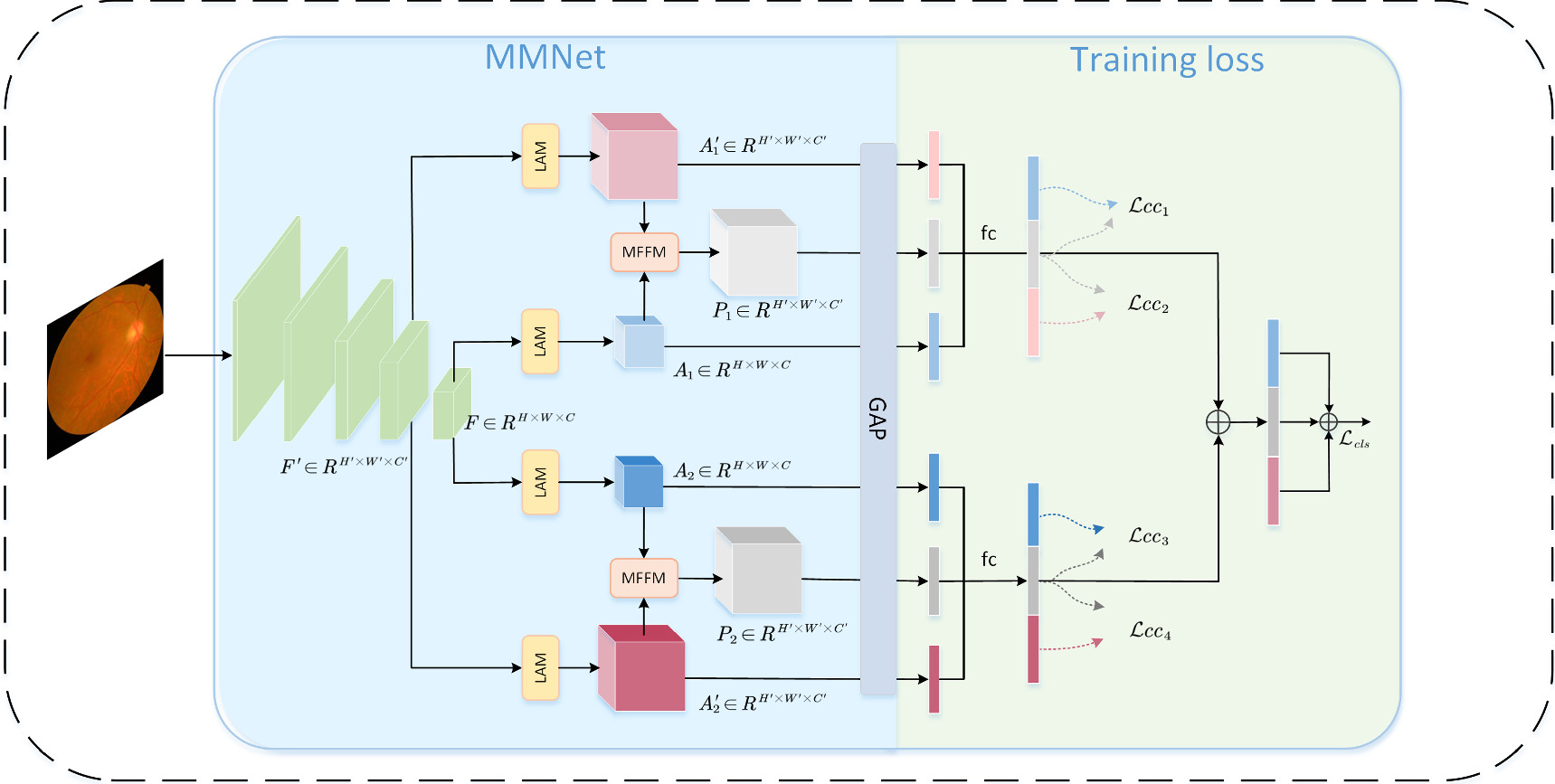 Multi-scale multi-attention network for diabetic retinopathy grading ...