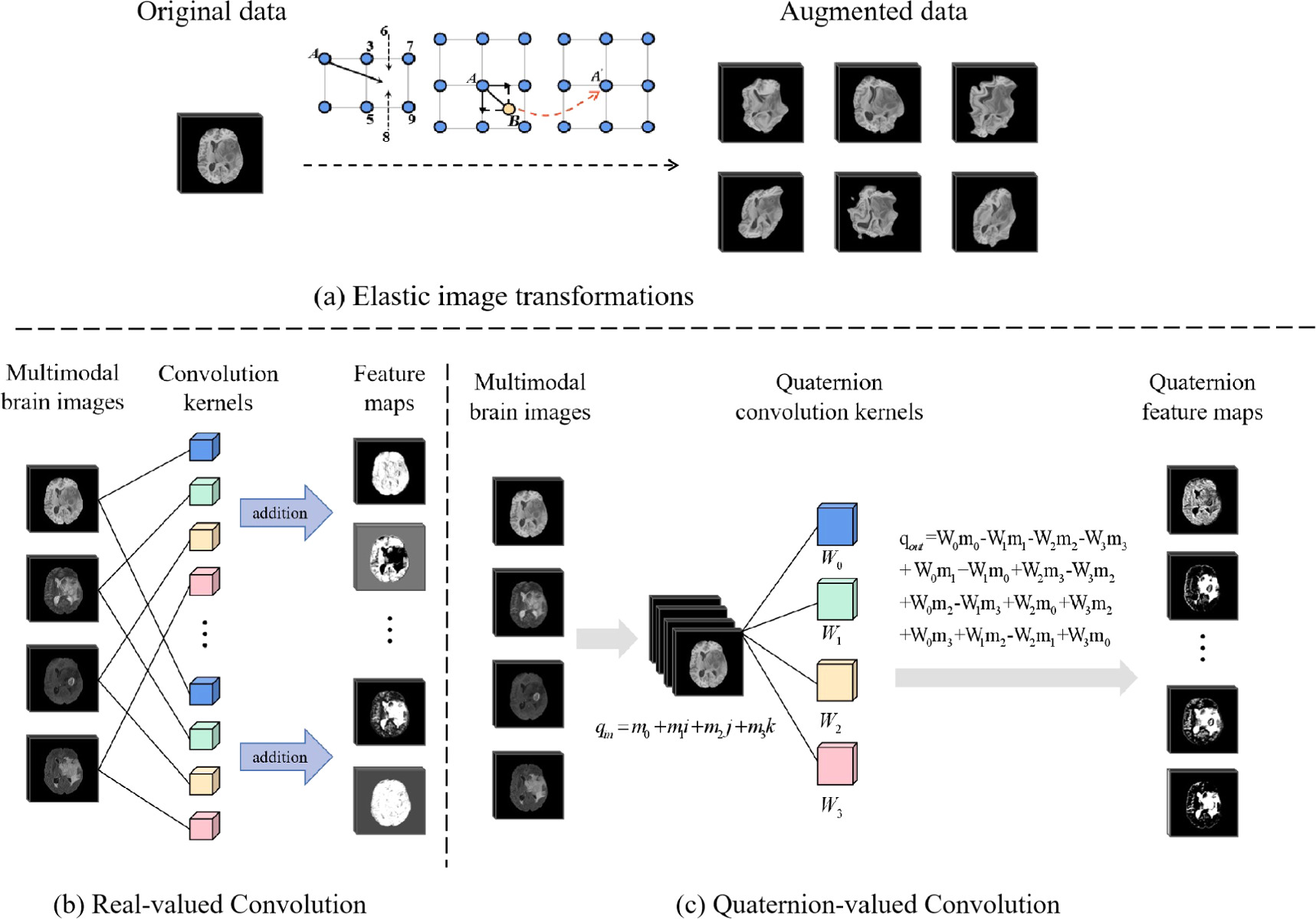 QMLS: quaternion mutual learning strategy for multi-modal brain tumor segmentation - IOPscience
