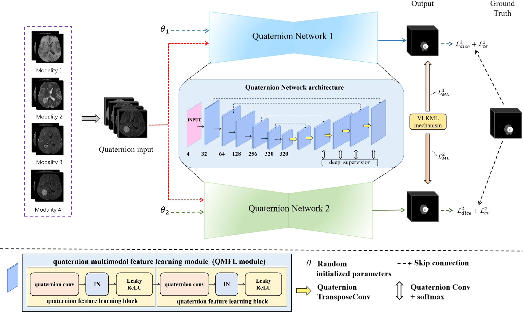 QMLS: quaternion mutual learning strategy for multi-modal brain tumor segmentation - IOPscience
