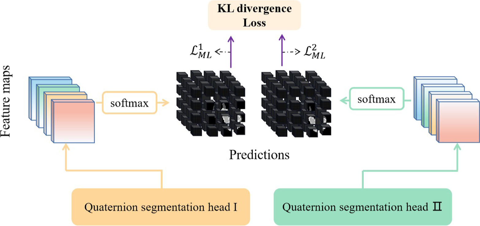 QMLS: quaternion mutual learning strategy for multi-modal brain tumor segmentation - IOPscience