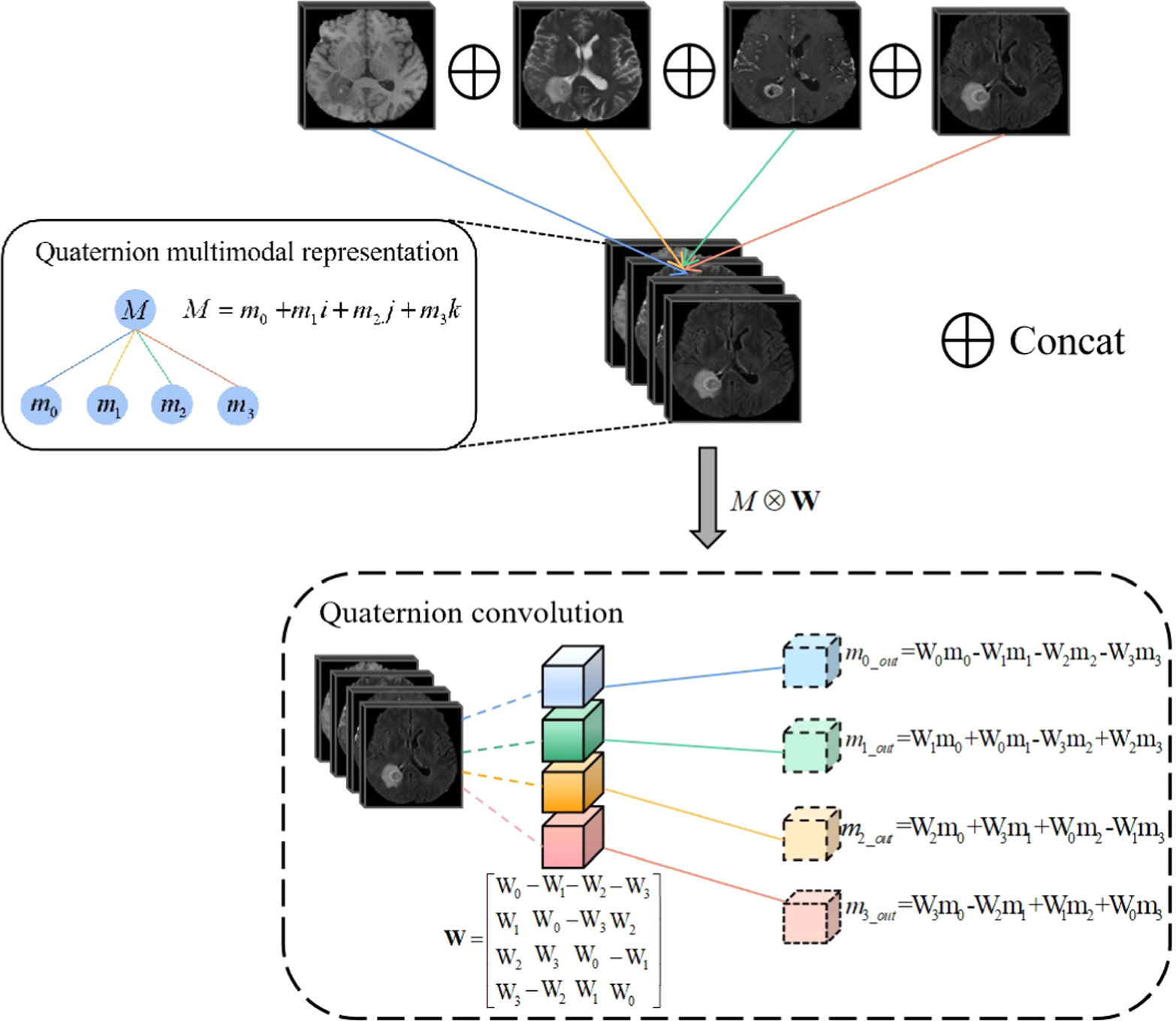 QMLS: quaternion mutual learning strategy for multi-modal brain tumor segmentation - IOPscience