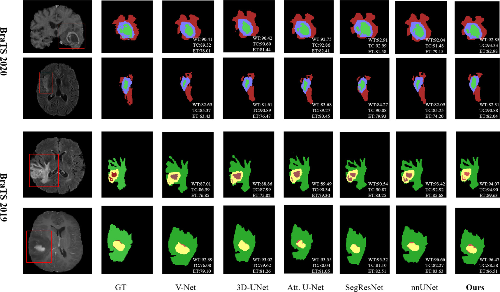 QMLS: quaternion mutual learning strategy for multi-modal brain tumor segmentation - IOPscience