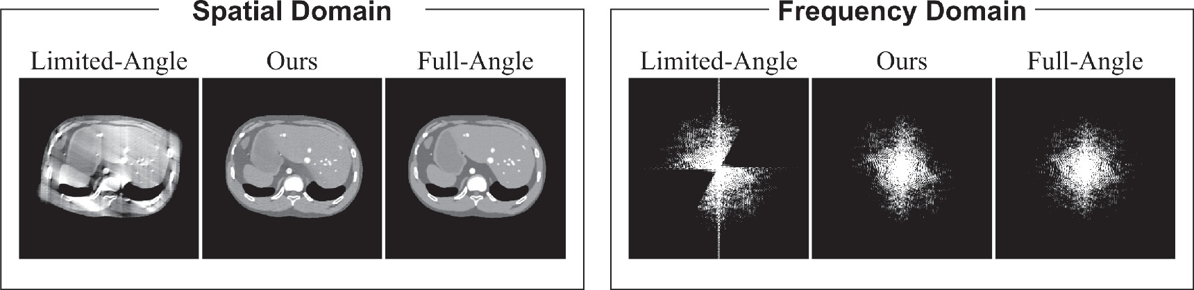 Iterative reconstruction for limited-angle CT using implicit neural ...