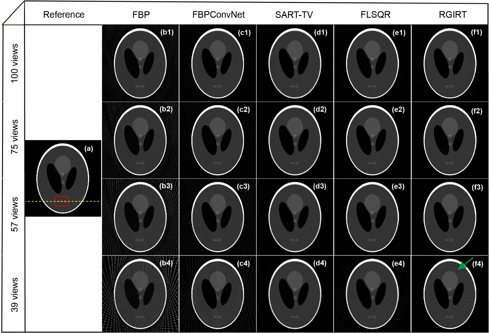 Robust residual-guided iterative reconstruction for sparse-view CT in ...
