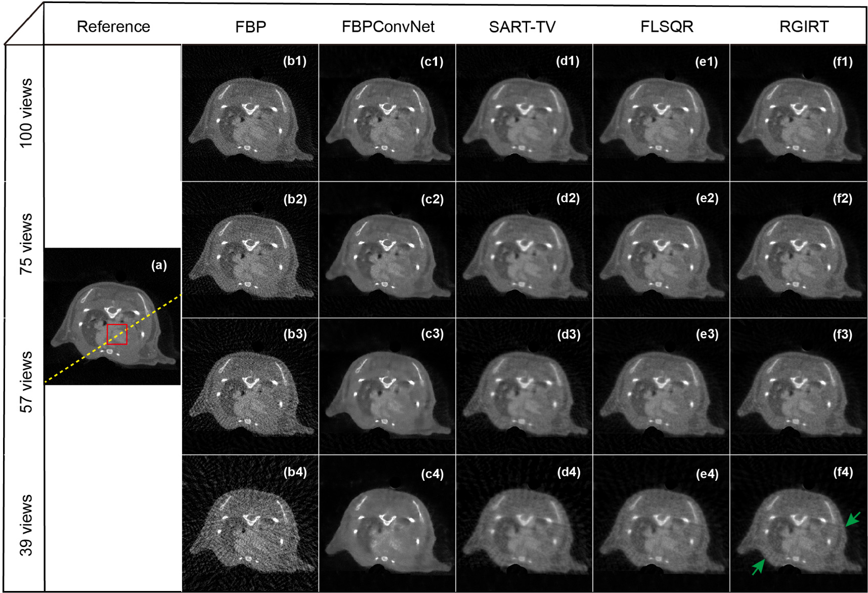Robust residual-guided iterative reconstruction for sparse-view CT in ...
