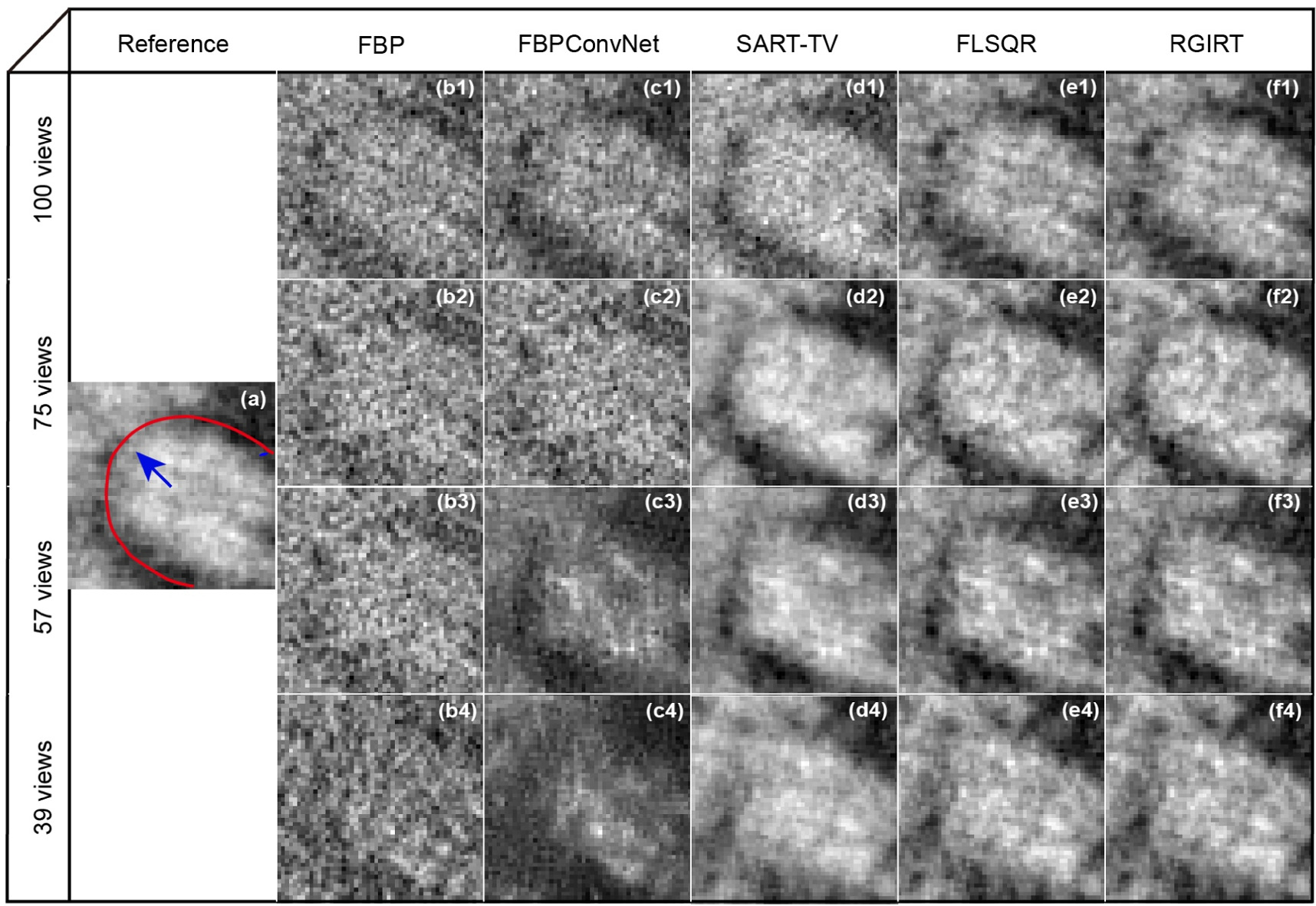 Robust residual-guided iterative reconstruction for sparse-view CT in ...
