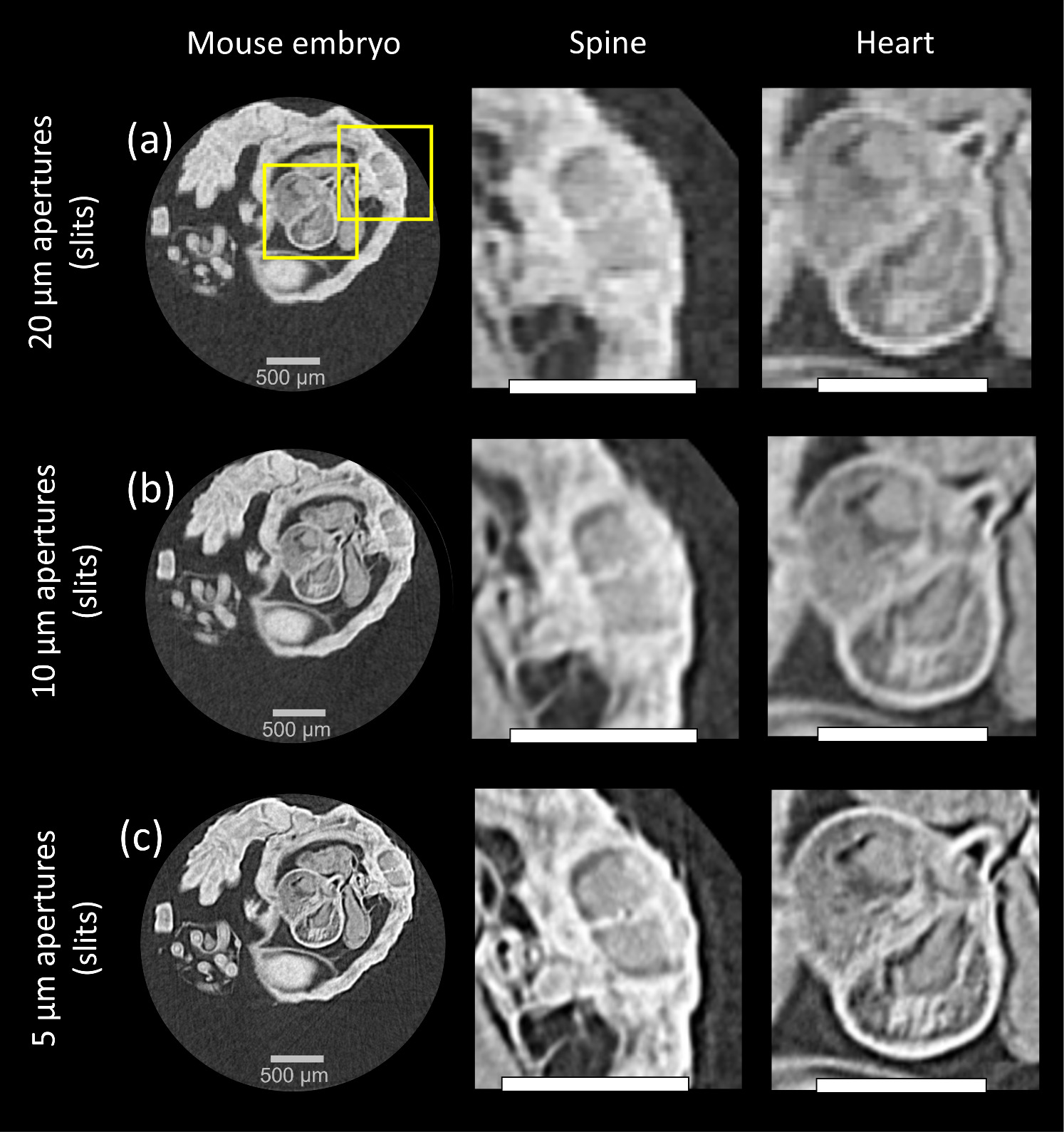 Phase contrast micro-CT with adjustable in-slice spatial resolution at ...
