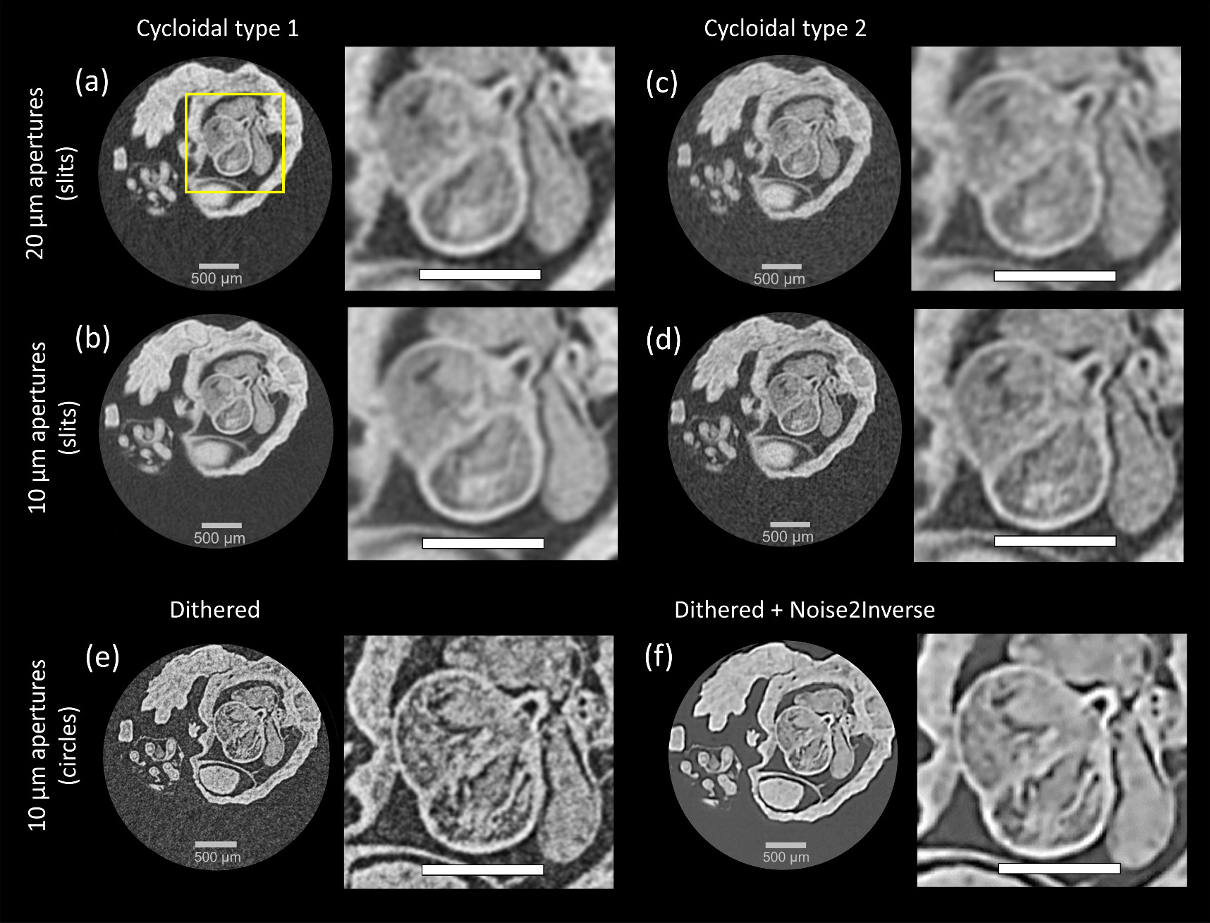 Phase contrast micro-CT with adjustable in-slice spatial resolution at ...