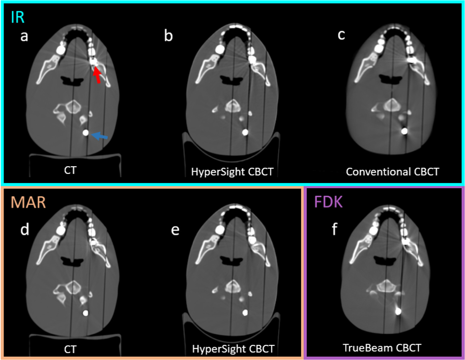 Image quality evaluation of a new high-performance ring-gantry cone ...