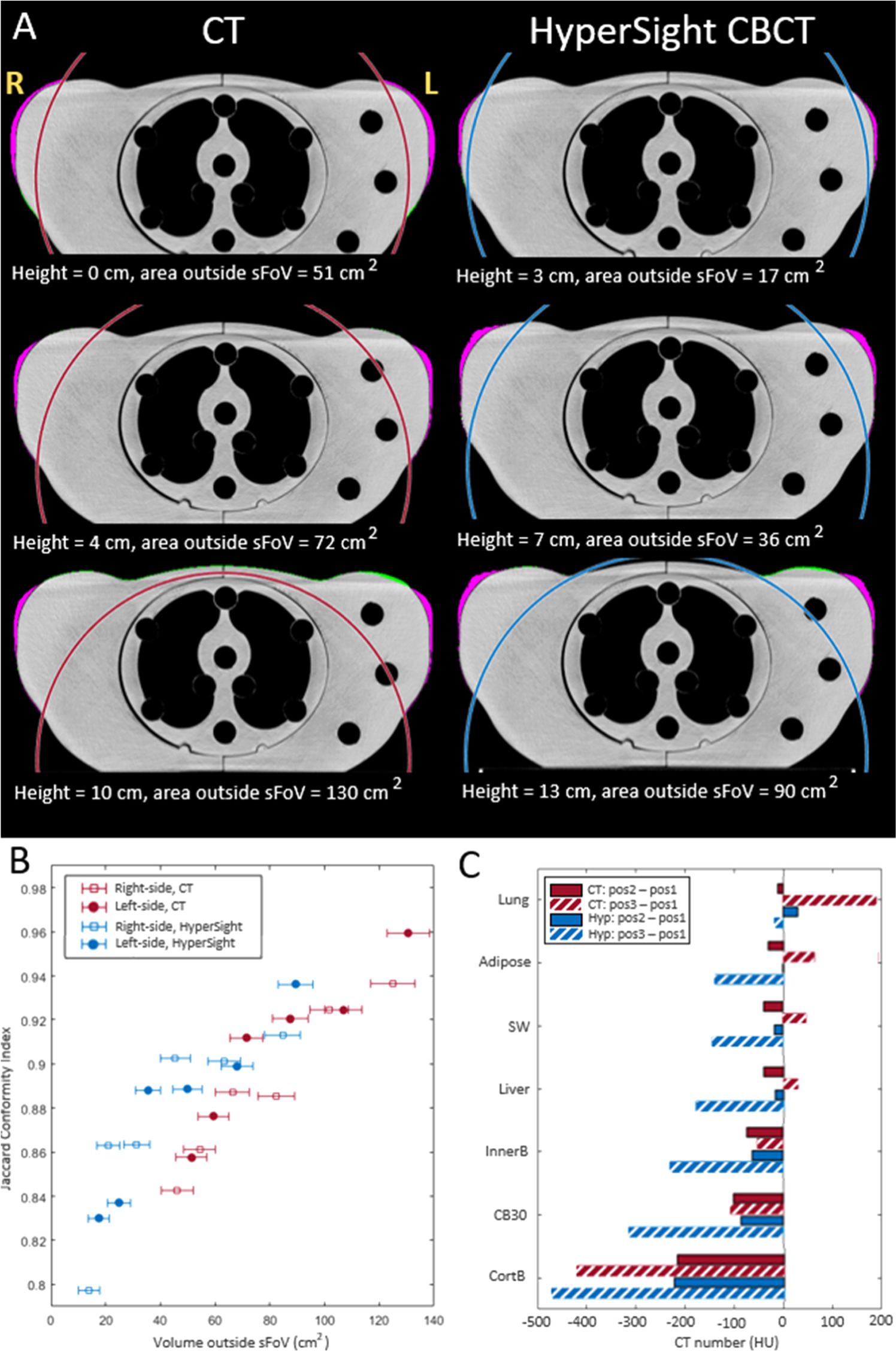 Image quality evaluation of a new high-performance ring-gantry cone ...