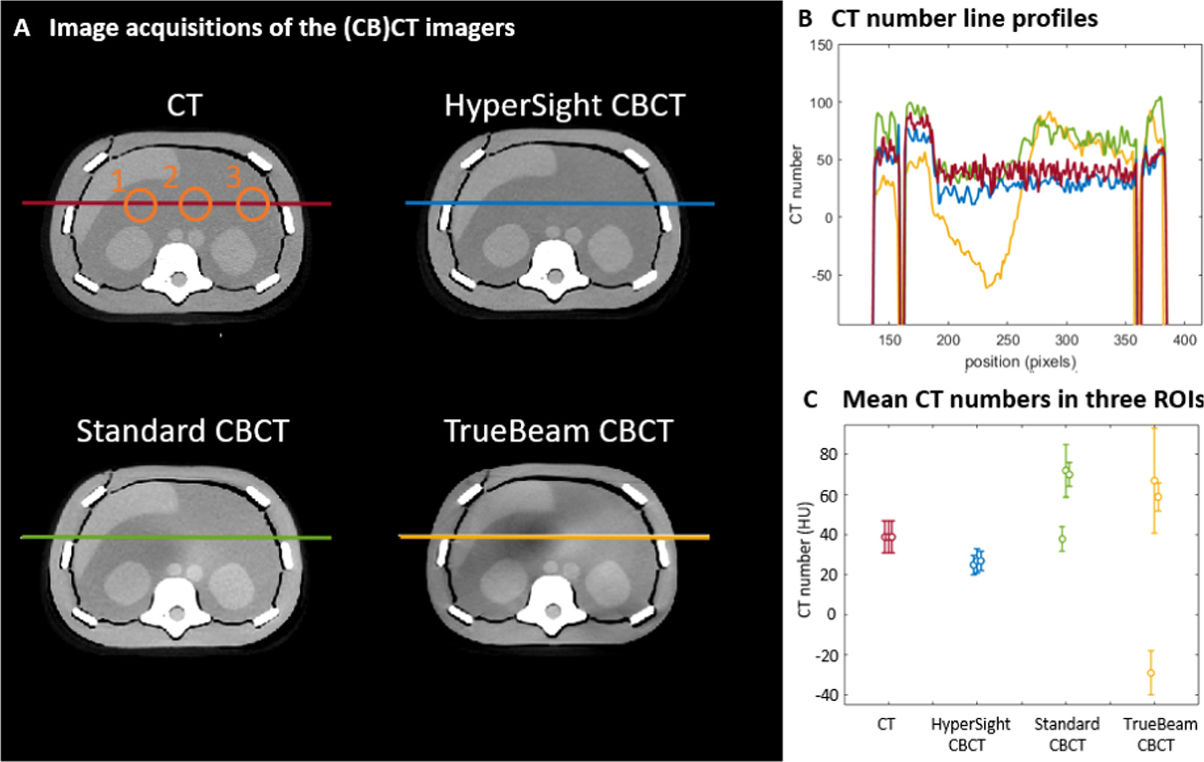 Image quality evaluation of a new high-performance ring-gantry cone ...