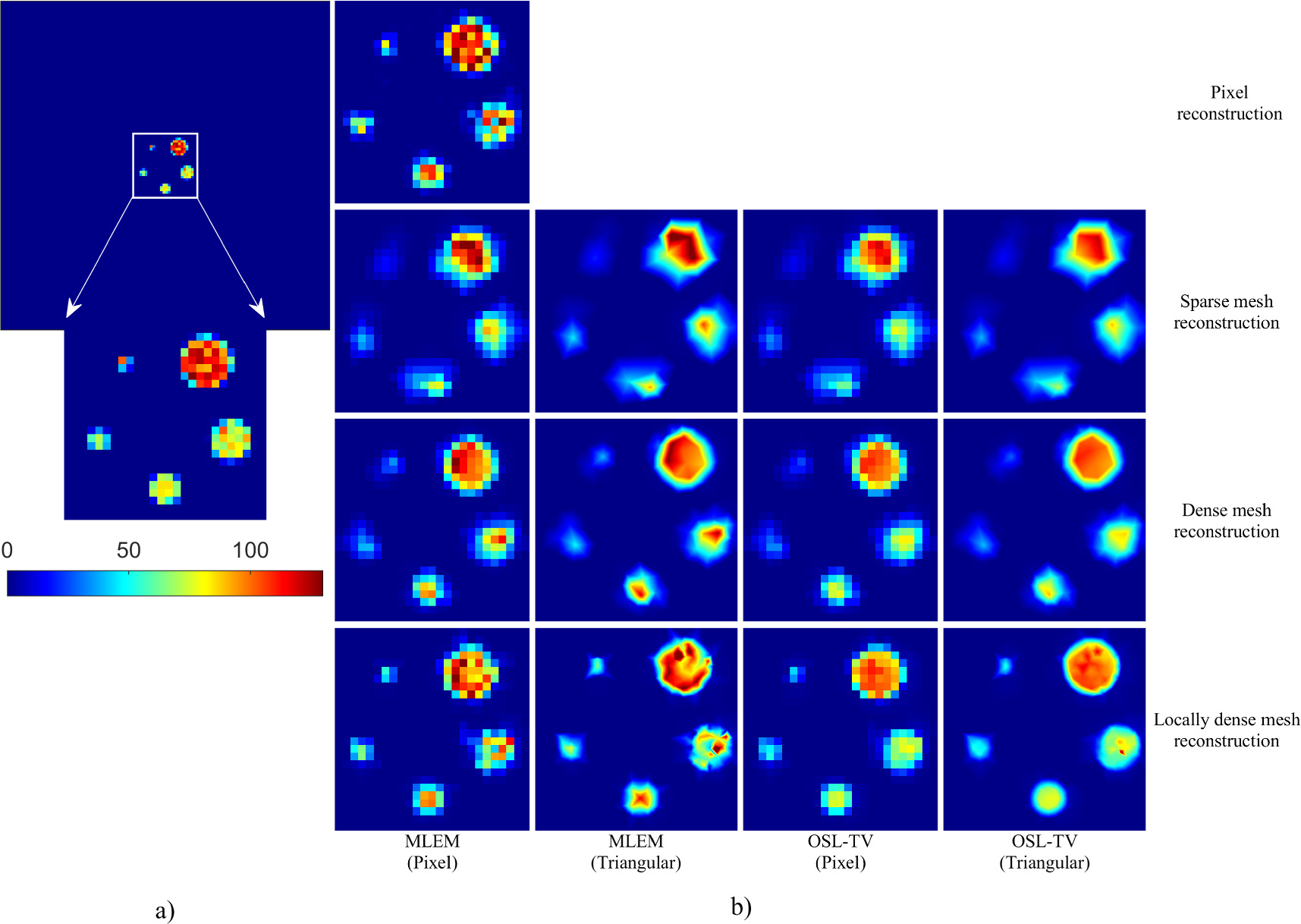 Anatomy-guided multi-resolution image reconstruction in PET - IOPscience