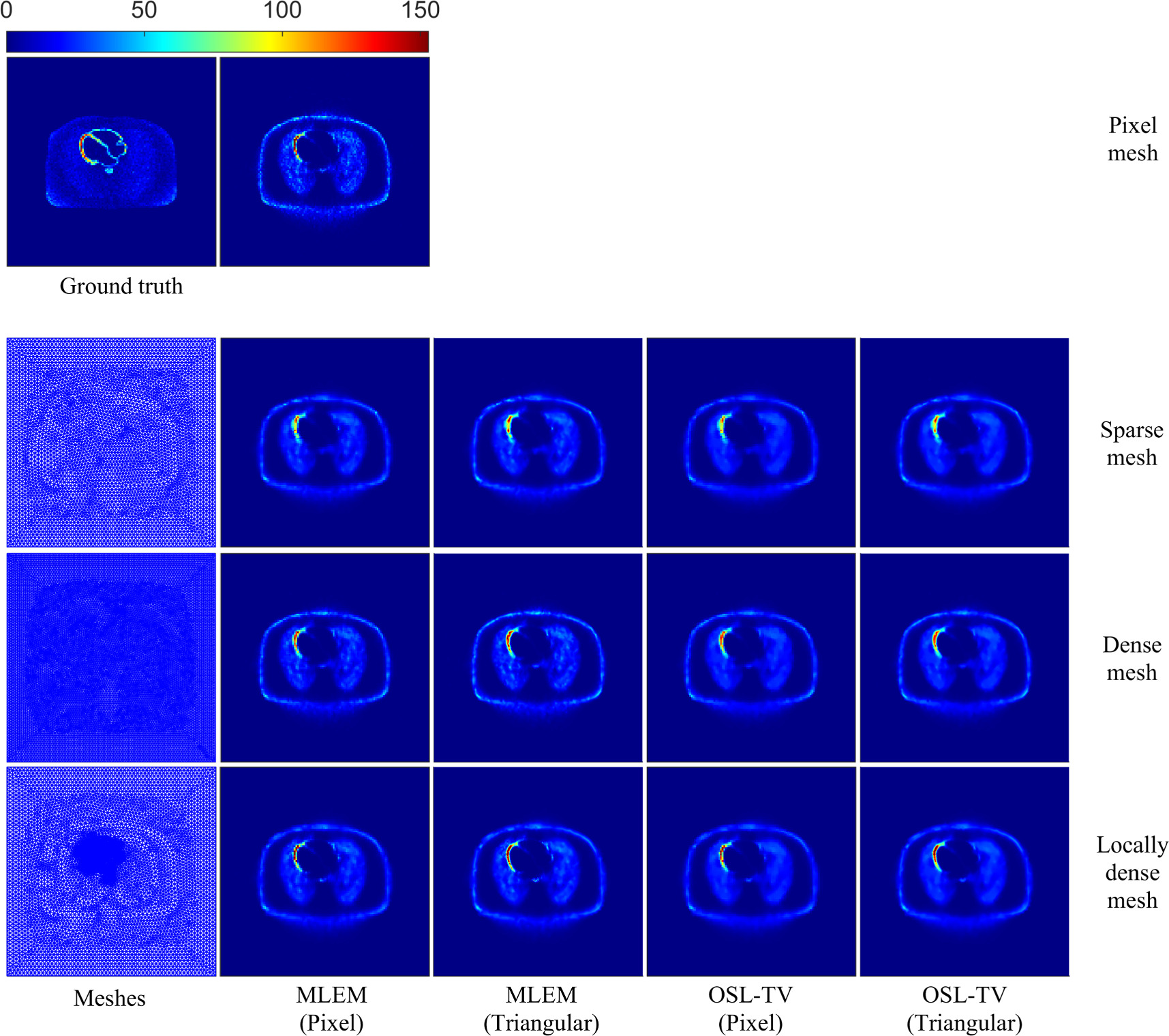 Anatomy-guided multi-resolution image reconstruction in PET - IOPscience