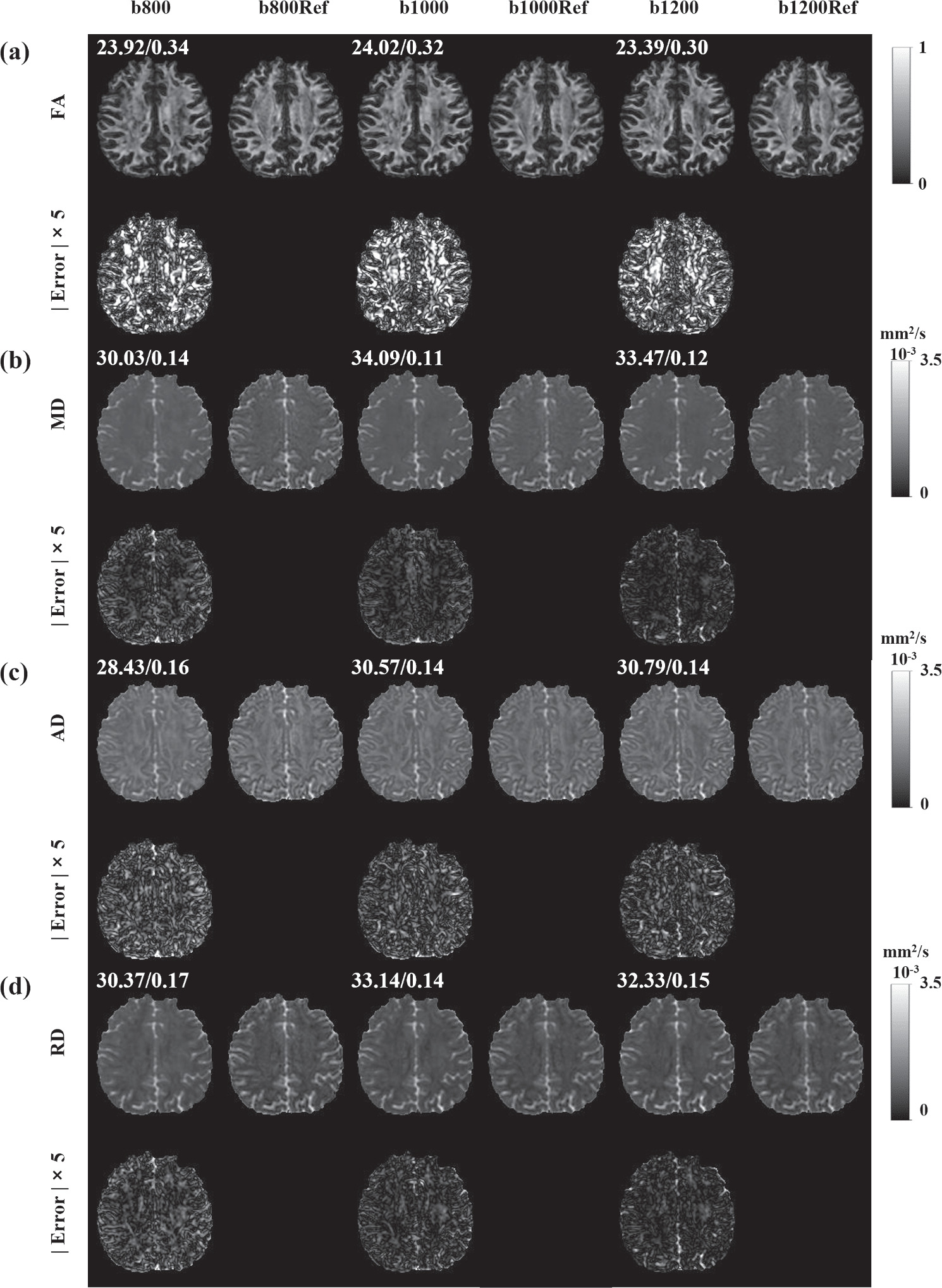 FlexDTI: flexible diffusion gradient encoding scheme-based highly ...