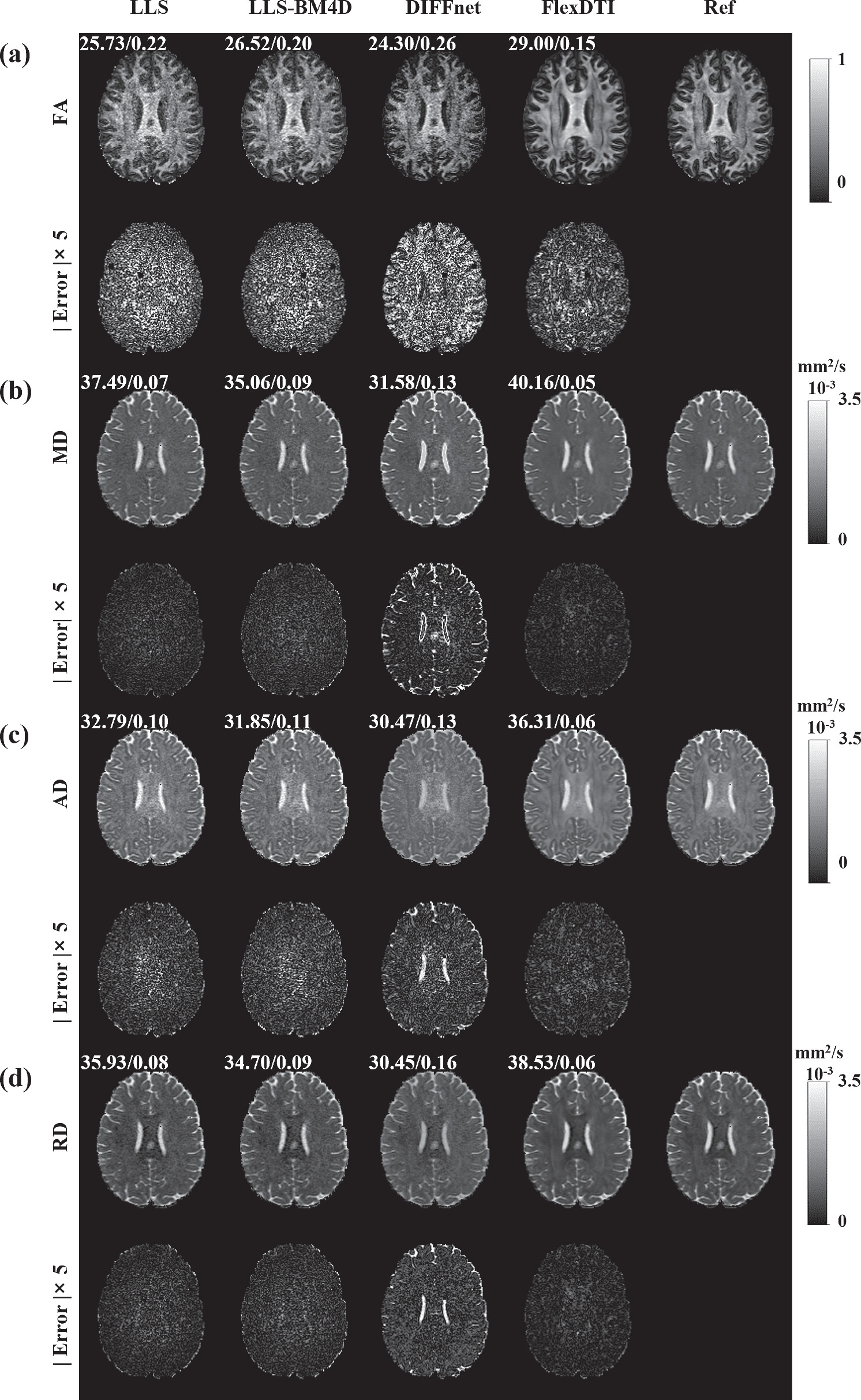 FlexDTI: flexible diffusion gradient encoding scheme-based highly efficient diffusion tensor ...